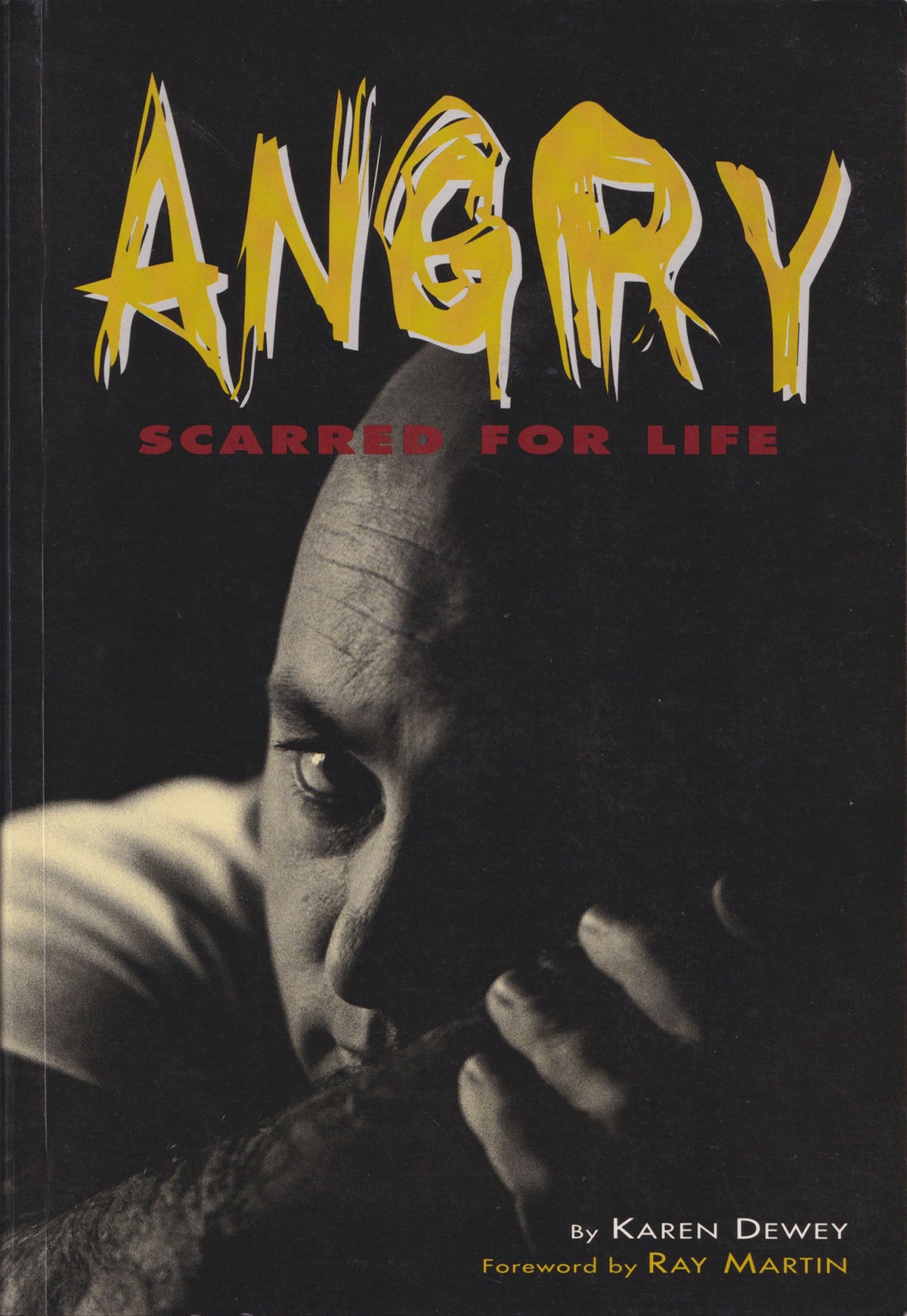 Scarred For Life – Rare Records